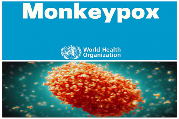 Multi-country monkeypox outbreak - Caribbean News Global