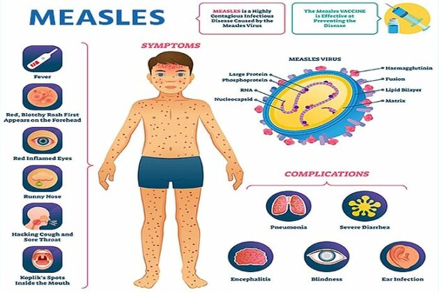 United States - Mexico to review measles elimination status - Caribbean ...