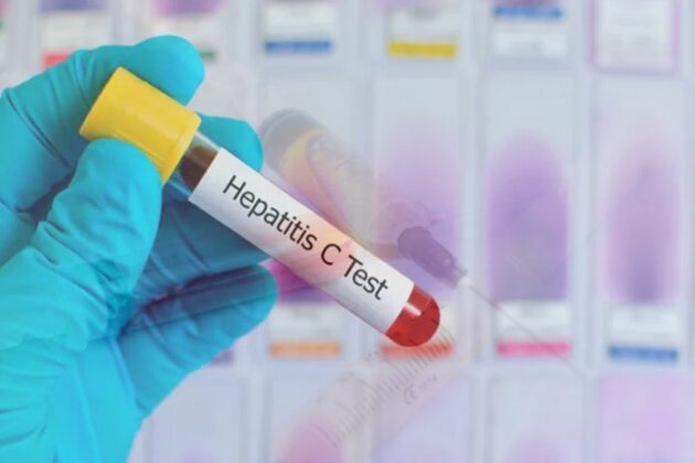WHO prequalifies the first self-test for hepatitis C virus - Caribbean ...